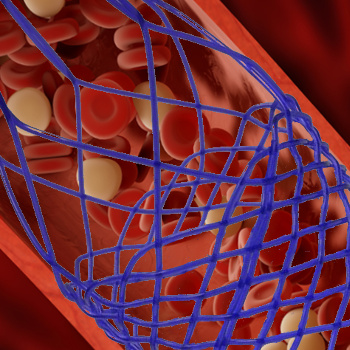 Catheter Delivery System Design | NOVO Engineering